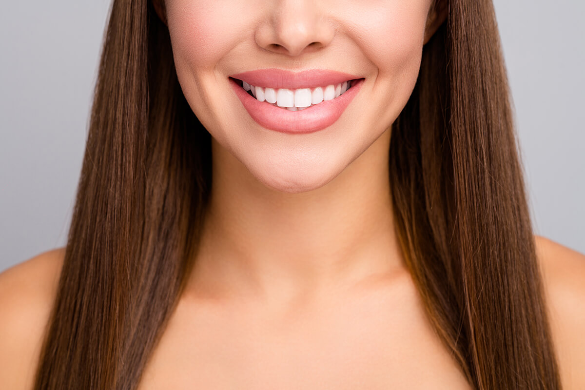 Hollywood Smile (Veneers, Zirconium) - Adora